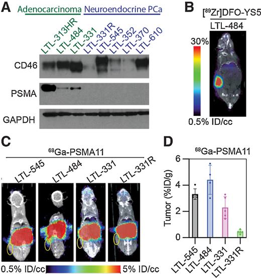 Treatment of Prostate Cancer with CD46-targeted 225Ac Alpha Particle ...