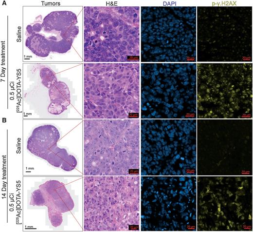 Treatment of Prostate Cancer with CD46-targeted 225Ac Alpha Particle ...