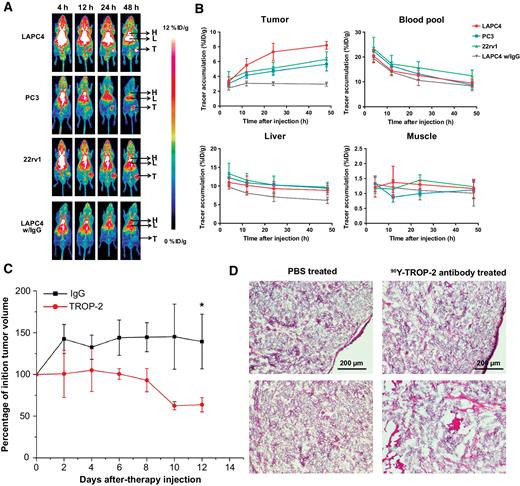 Expression and Therapeutic Targeting of TROP-2 in Treatment-Resistant ...