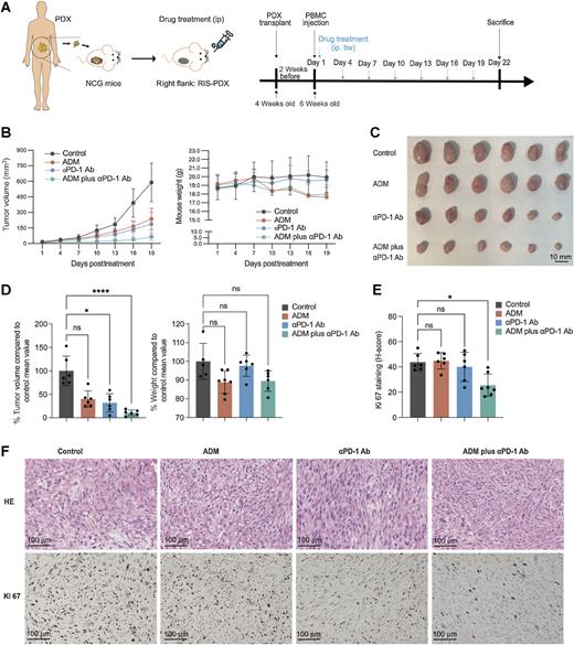 Genomic Profiling of Radiation-Induced Sarcomas Reveals the Immunologic ...
