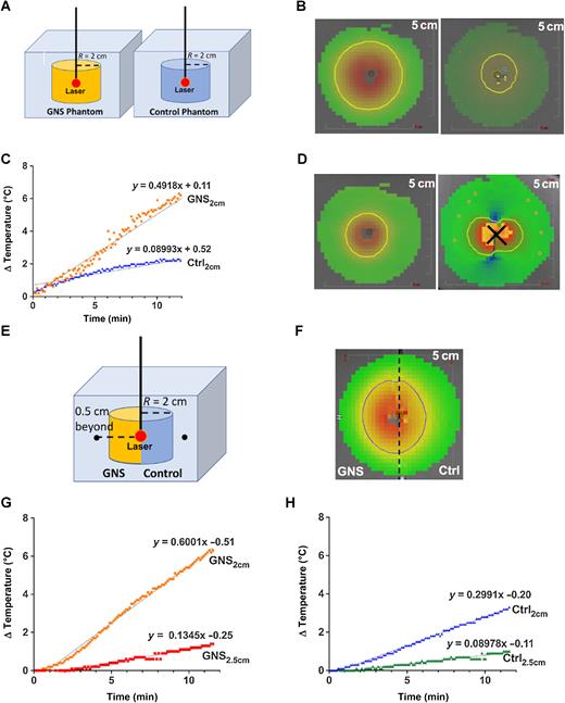 Gold Nanostars Obviate Limitations to Laser Interstitial Thermal ...