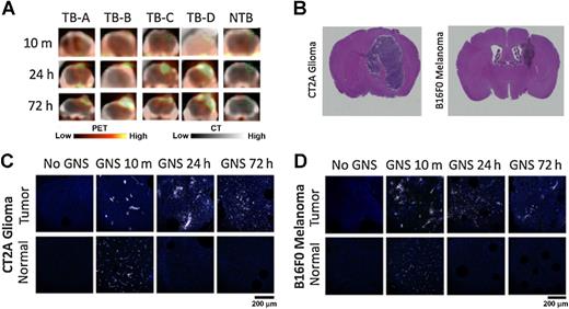 Gold Nanostars Obviate Limitations to Laser Interstitial Thermal ...