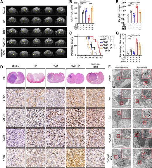 The DRD2 Antagonist Haloperidol Mediates Autophagy-Induced Ferroptosis ...