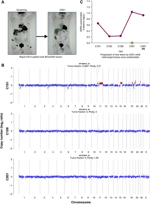 Phase I Study of Acalabrutinib Plus Danvatirsen (AZD9150) in Relapsed ...