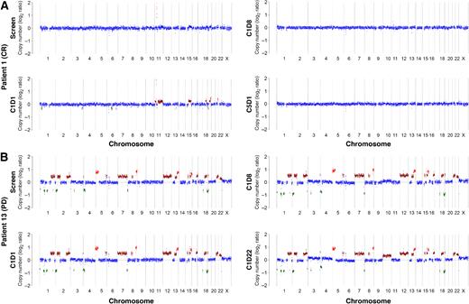 Phase I Study of Acalabrutinib Plus Danvatirsen (AZD9150) in Relapsed ...