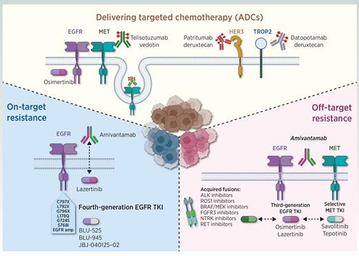 Tackling Osimertinib Resistance in EGFR-Mutant Non–Small Cell Lung ...