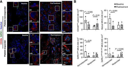 A Phase Ib Trial of AVID200, a TGFβ 1/3 Trap, in Patients with ...