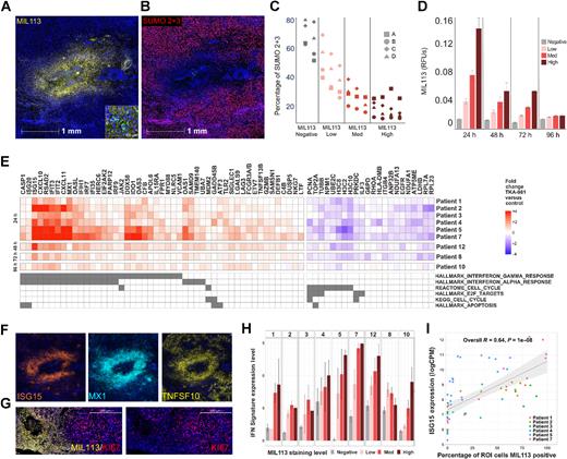 Trackable Intratumor Microdosing and Spatial Profiling Provide Early ...