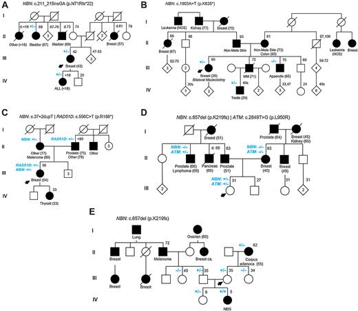NBN Pathogenic Germline Variants are Associated with Pan-Cancer ...