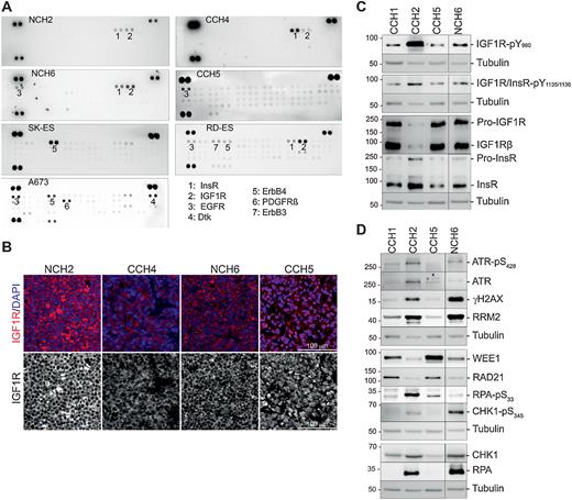 Molecularly Defined Subsets of Ewing Sarcoma Tumors Differ in Their ...