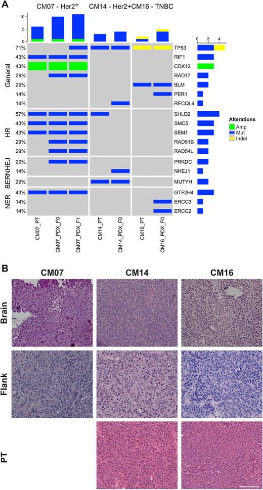 ATM-Inhibitor AZD1390 Is a Radiosensitizer for Breast Cancer CNS ...