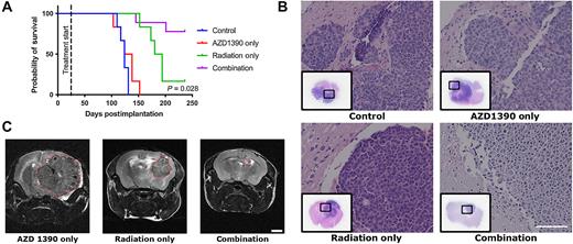 ATM-Inhibitor AZD1390 Is a Radiosensitizer for Breast Cancer CNS ...