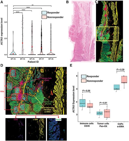 ACTA2 Expression Predicts Survival and Is Associated with Response to ...