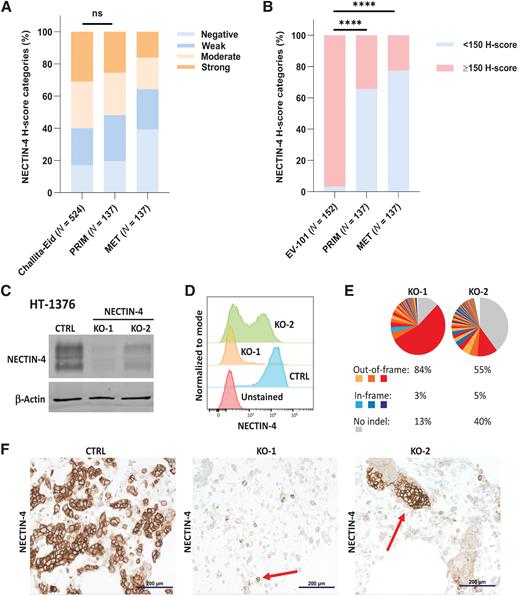 Membranous NECTIN-4 Expression Frequently Decreases during Metastatic ...