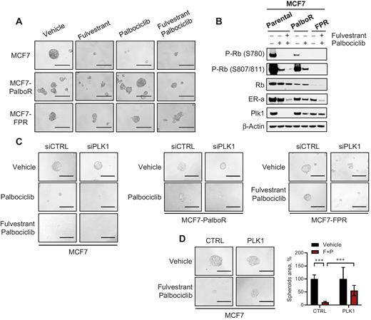 CCNE1 and PLK1 Mediate Resistance to Palbociclib in HR+/HER2− ...