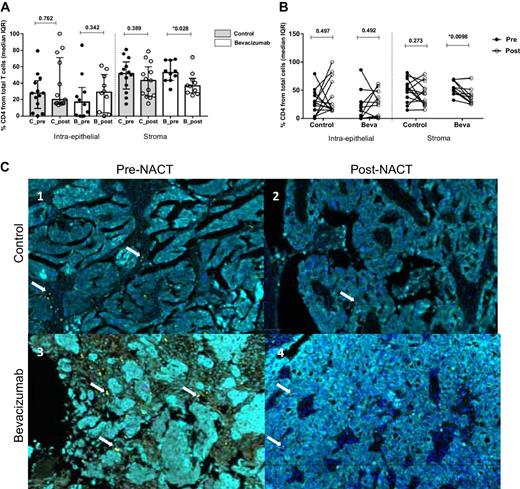 Analysis of Tumor Microenvironment Changes after Neoadjuvant ...