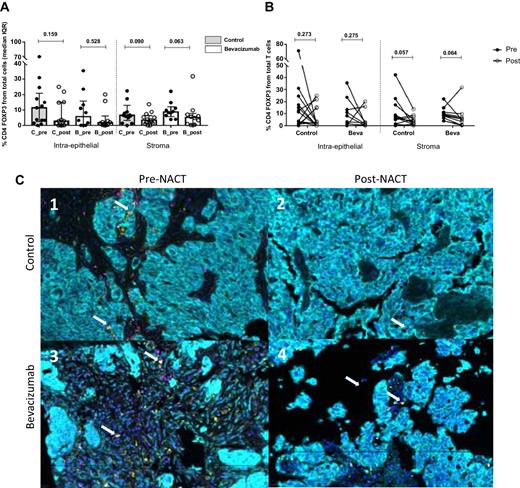 Analysis of Tumor Microenvironment Changes after Neoadjuvant ...