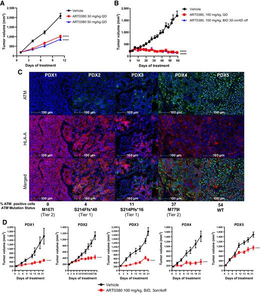 Ataxia-Telangiectasia Mutated Loss-of-Function Displays Variant and ...