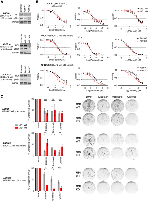 Concurrent RB1 Loss and BRCA Deficiency Predicts Enhanced Immunologic ...