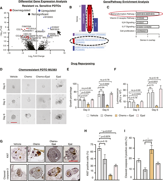 Targeting AKR1B10 by Drug Repurposing with Epalrestat Overcomes ...