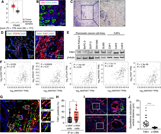 TAK1 Promotes an Immunosuppressive Tumor Microenvironment through ...