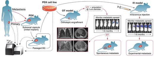Osteosarcoma PDX-Derived Cell Line Models for Preclinical Drug Evaluation Demonstrate Metastasis ...