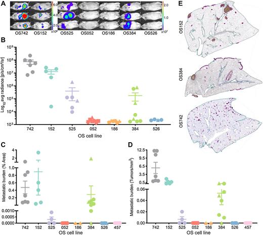 Osteosarcoma PDX-Derived Cell Line Models for Preclinical Drug ...
