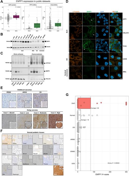 Surface and Global Proteome Analyses Identify ENPP1 and Other Surface ...