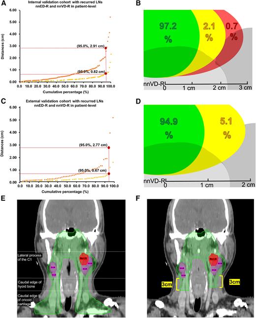 Optimizing Cervical Target Volume in Patients with Nasopharyngeal ...