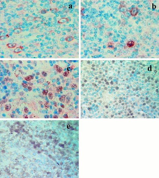 Retinoblastoma-related p107 and pRb2/p130 Proteins in Malignant ...