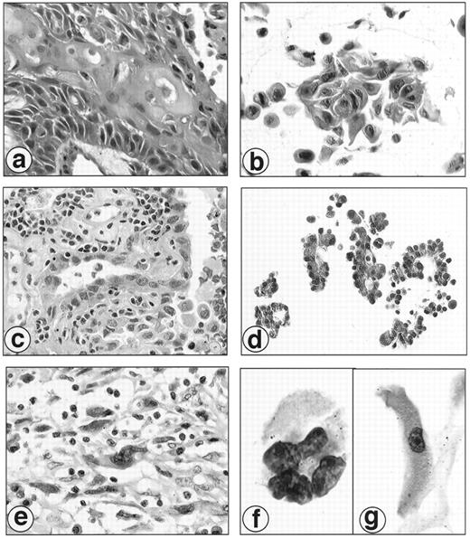 Comparison of Features of Human Lung Cancer Cell Lines and Their ...