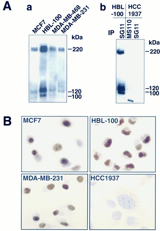 Reduction of BRCA1 Protein Expression in Japanese Sporadic Breast ...