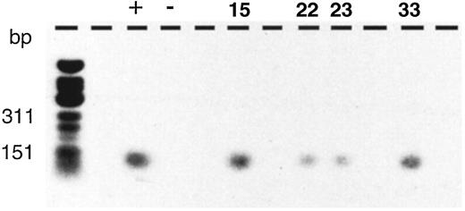 Detection and Quantitation of Human Papillomavirus (HPV) DNA in the ...