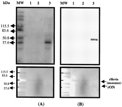 Differential Expression of Osteonectin/SPARC during Human Prostate ...