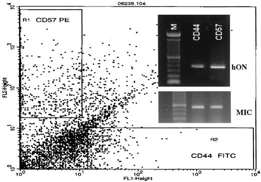 Differential Expression of Osteonectin/SPARC during Human Prostate ...