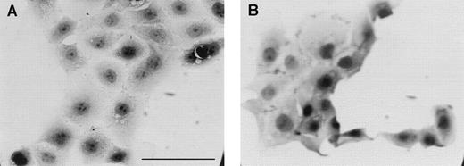 In Vivo and in Vitro Ovarian Carcinoma Growth Inhibition by a ...