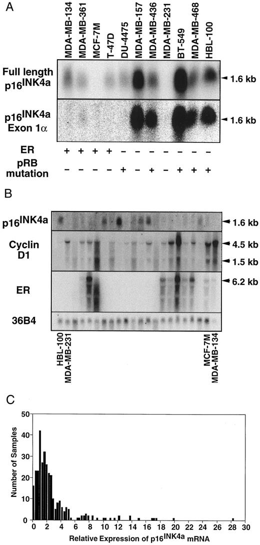 INK4a Gene Expression and Methylation in Primary Breast Cancer ...