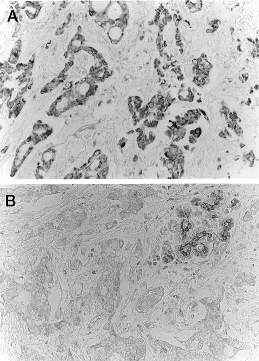 Clinicopathological Significance of Fragile Histidine Triad ...