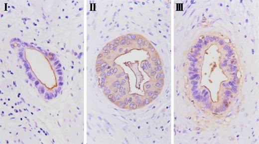 Expression of MUC1 Mucins in the Subserosal Layer Correlates with ...