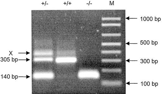 Prevalence of a Common Point Mutation in the Dihydropyrimidine ...