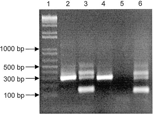 Prevalence of a Common Point Mutation in the Dihydropyrimidine ...