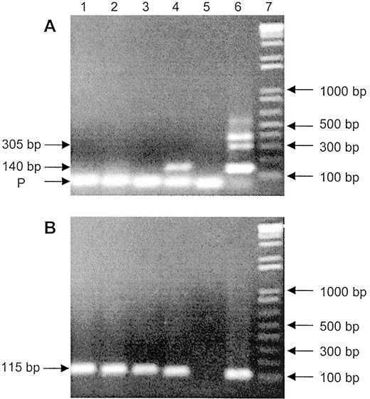 Prevalence of a Common Point Mutation in the Dihydropyrimidine ...
