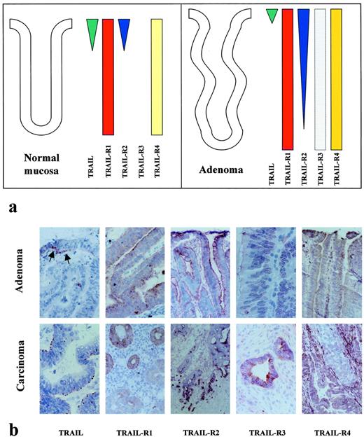 Expression of TRAIL and TRAIL Receptors in Colon Carcinoma: TRAIL-R1 Is ...