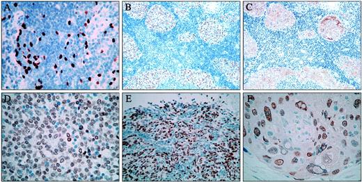 p63 Expression Profiles in Human Normal and Tumor Tissues1 | Clinical ...