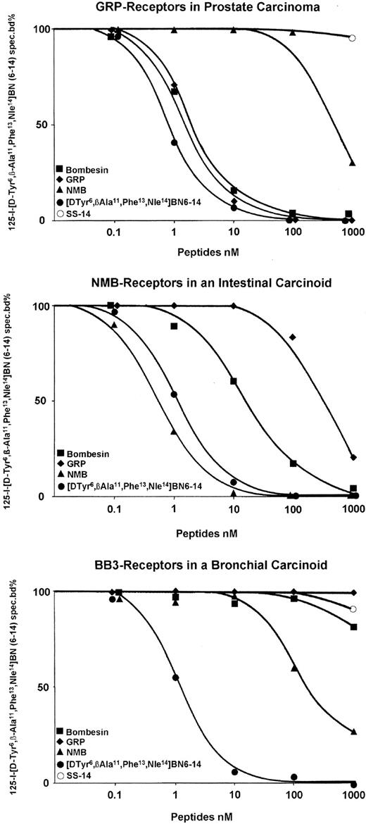 Bombesin Receptor Subtypes in Human Cancers | Clinical Cancer Research ...