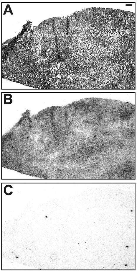Bombesin Receptor Subtypes in Human Cancers | Clinical Cancer Research ...