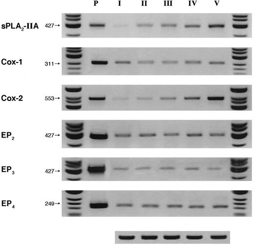 Expressions of Cyclooxygenase-2 and Prostaglandin E-Receptors in ...