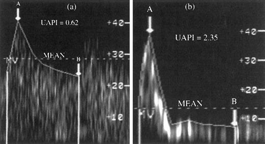 Doppler Ultrasonography of the Uterine Artery and the Response to ...