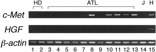 Expression of the c-Met Proto-Oncogene and Its Possible Involvement in ...