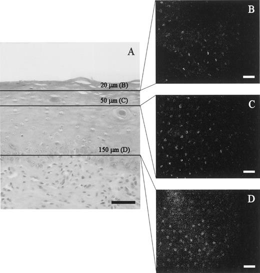 Confocal Microscopy for Real-Time Detection of Oral Cavity Neoplasia ...